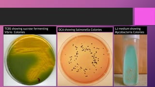 Culture media and Culture methods | PPTX