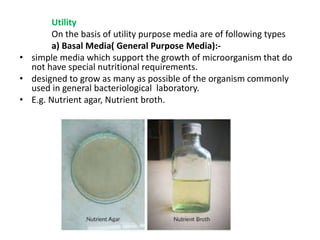 Culture media and types | PPTX