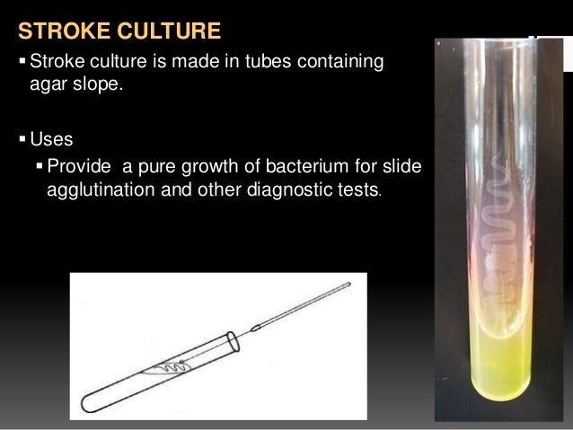 Culture media & culture methods copy