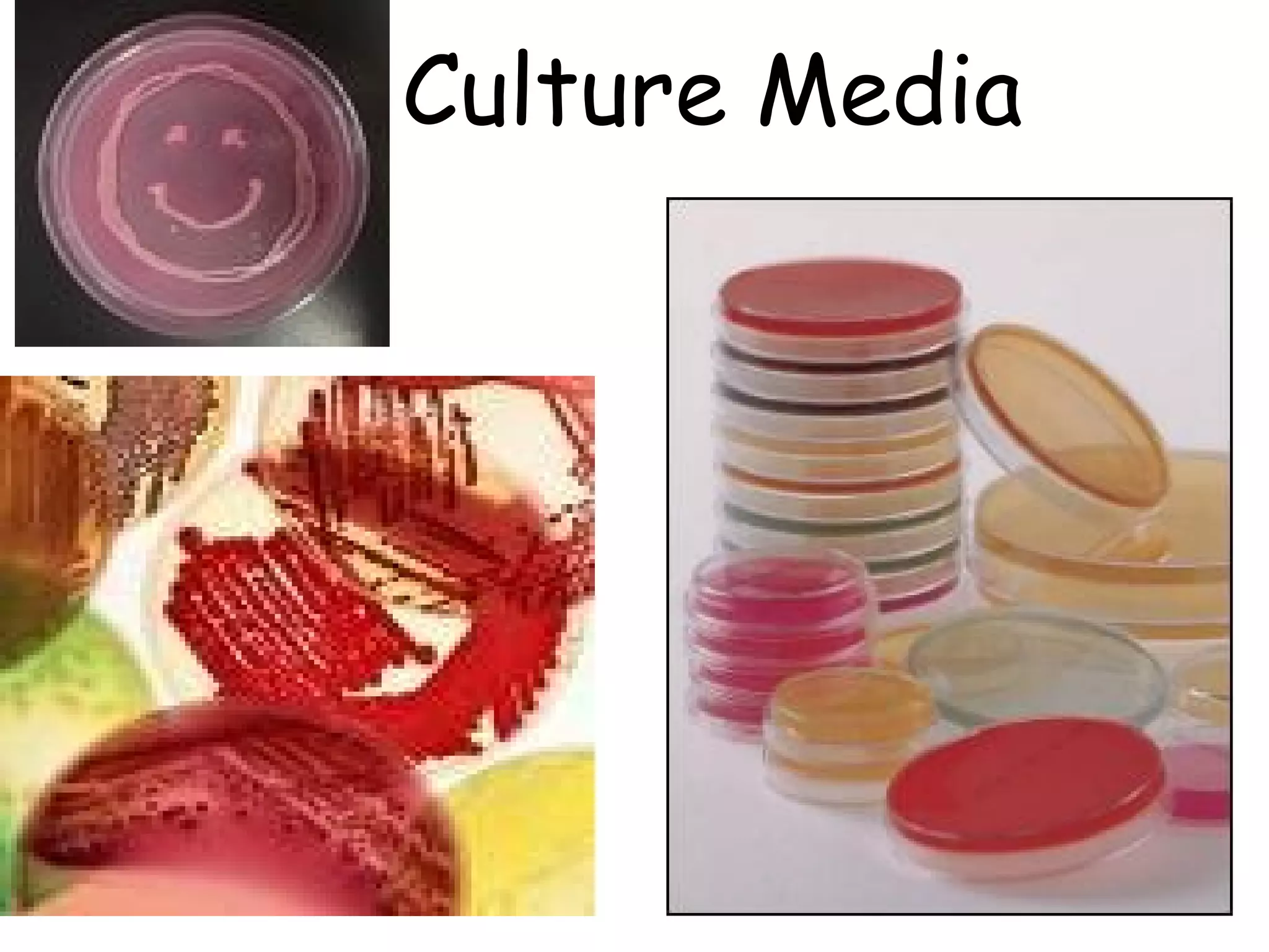 Culture media & culture methods (1) | PPT