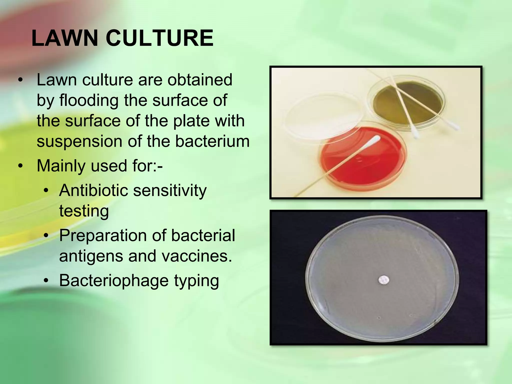 Bacterial Culture methods and method of anaerobiosis | PPT