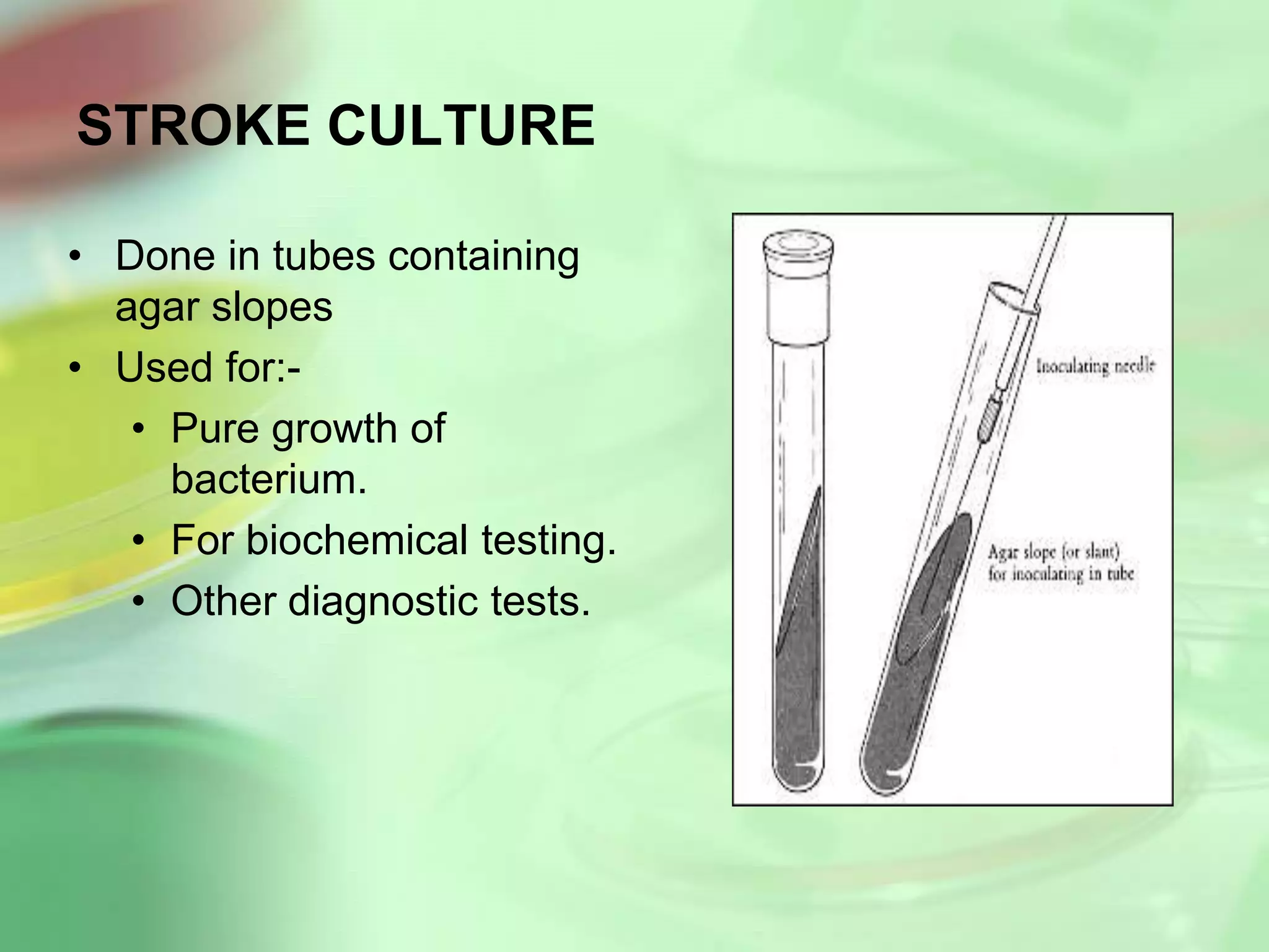 Bacterial Culture methods and method of anaerobiosis | PPTX