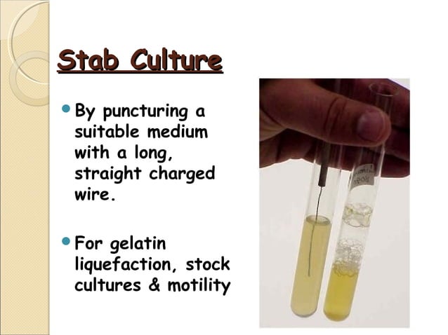 Culture methods | PPT | Infectious Diseases | Diseases and Conditions