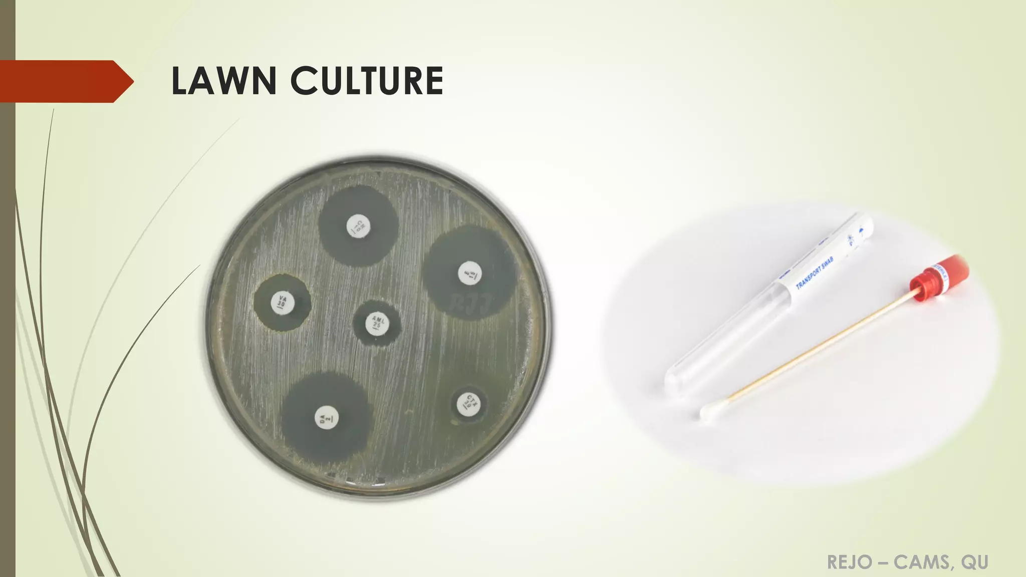 Bacterial Culture methods | PDF