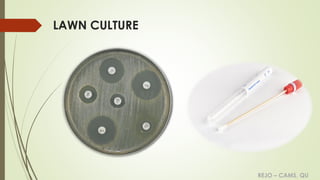 Bacterial Culture methods | PDF