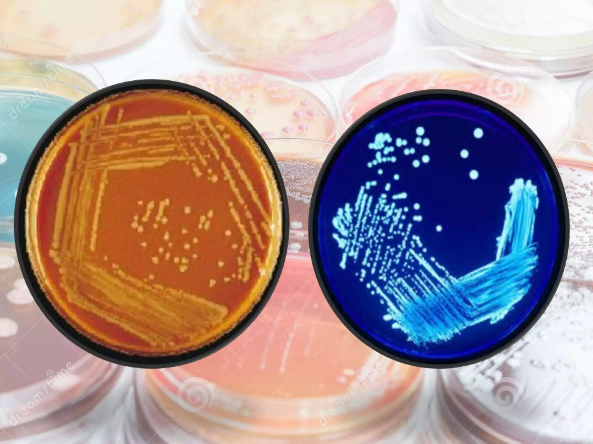 CULTURE METHODS | PPTX | Infectious Diseases | Diseases and Conditions