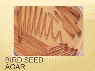 Culture of fungus | PPTX