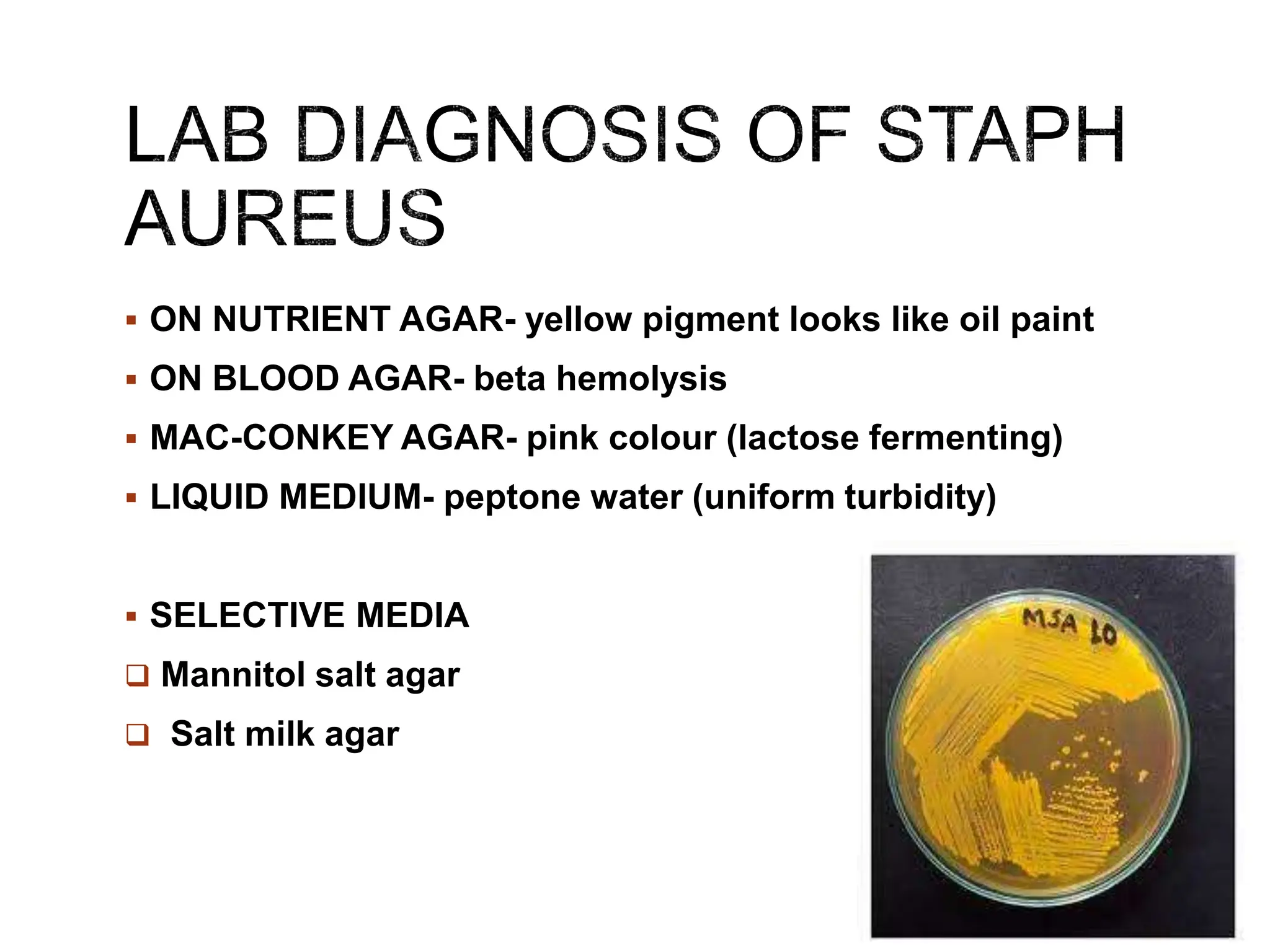 MRSA- Methicillin resistance Staphylococcus aureus | PPTX