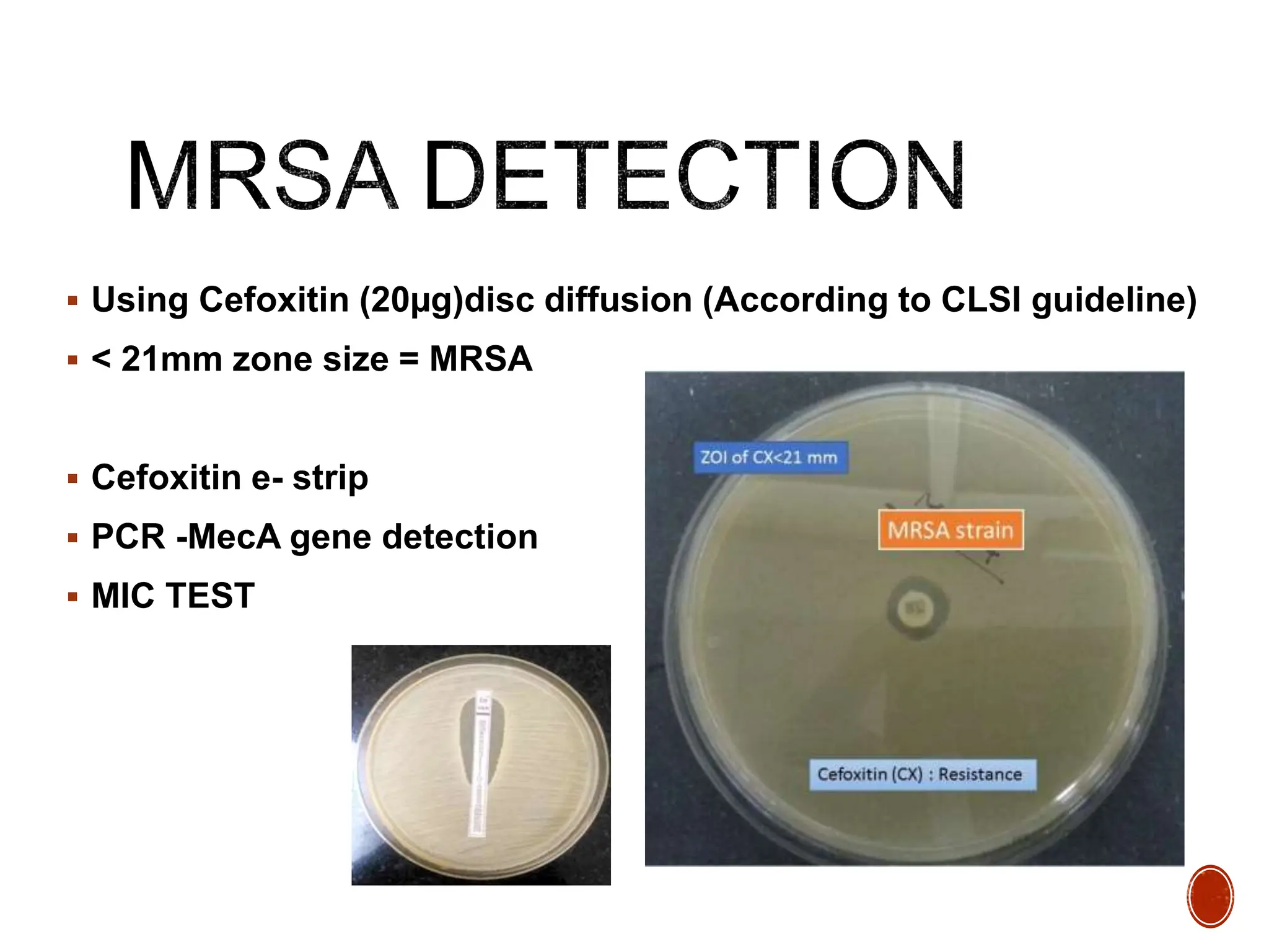 Mrsa Methicillin Resistance Staphylococcus Aureus Pptx Chemistry Science