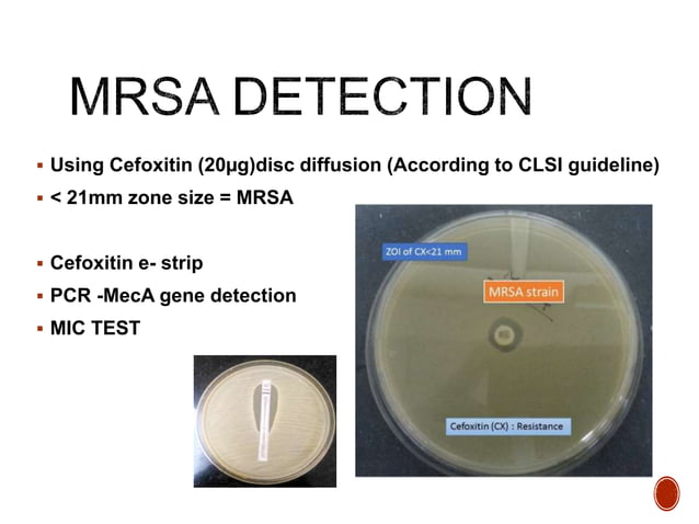 MRSA- Methicillin resistance Staphylococcus aureus | PPTX | Chemistry | Science