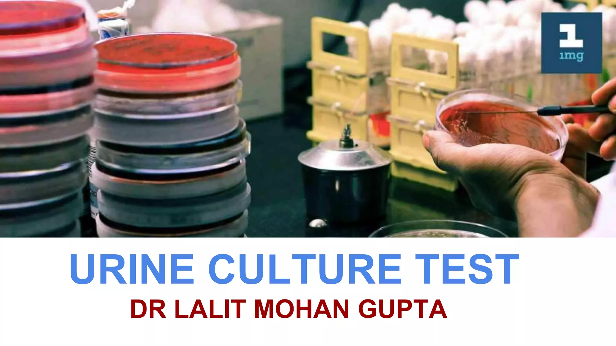 Urine Culture test | PPTX