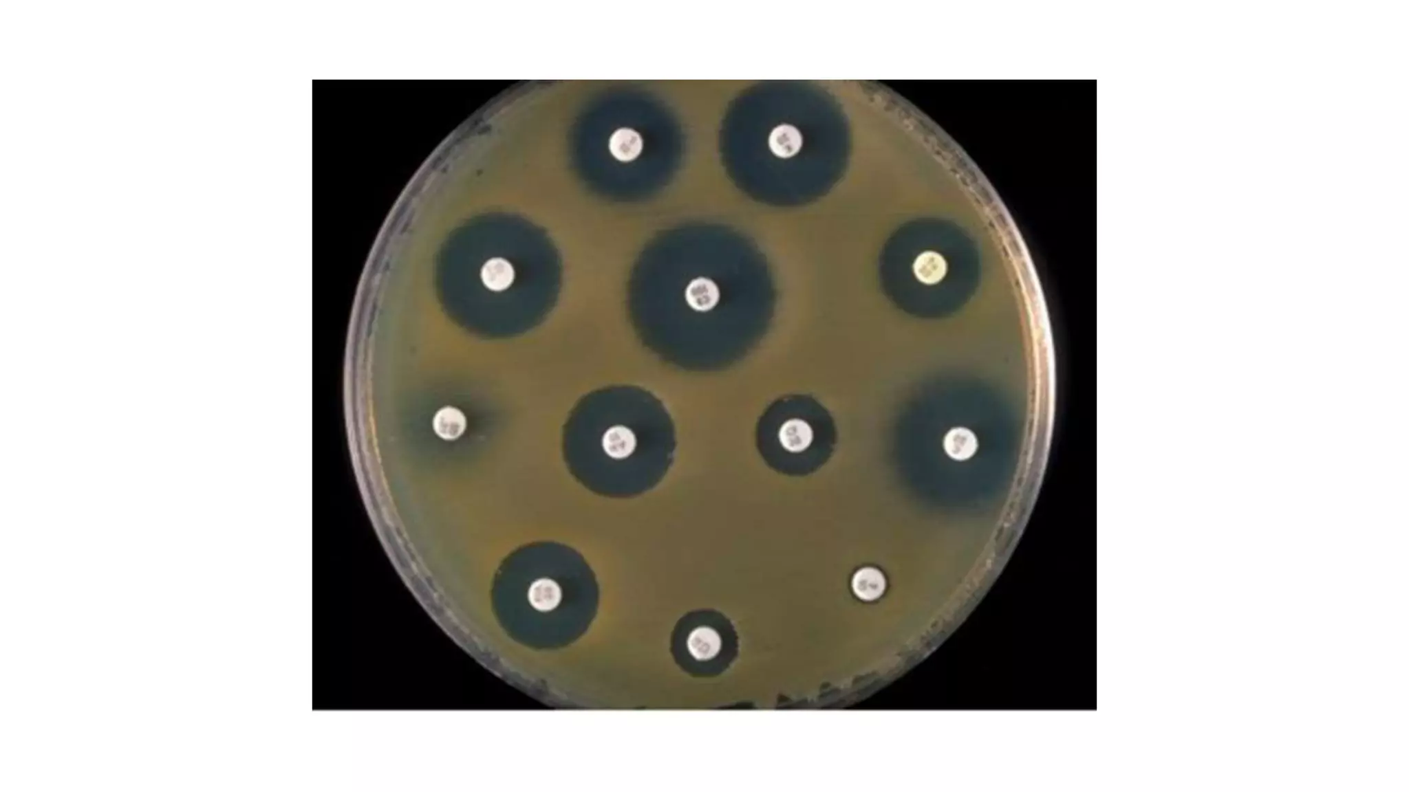 Culturing and inculation techniques used in Bacteriology.pptm.pptx ...