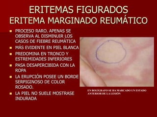 cupdf.com_eritemas-figurados.ppt