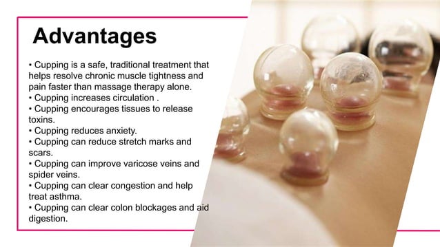 cupping حجامه.pptx