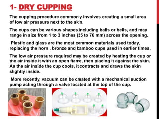 Cupping therapy | PPTX