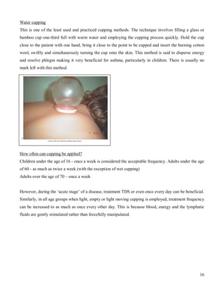 Cupping therapy | PDF