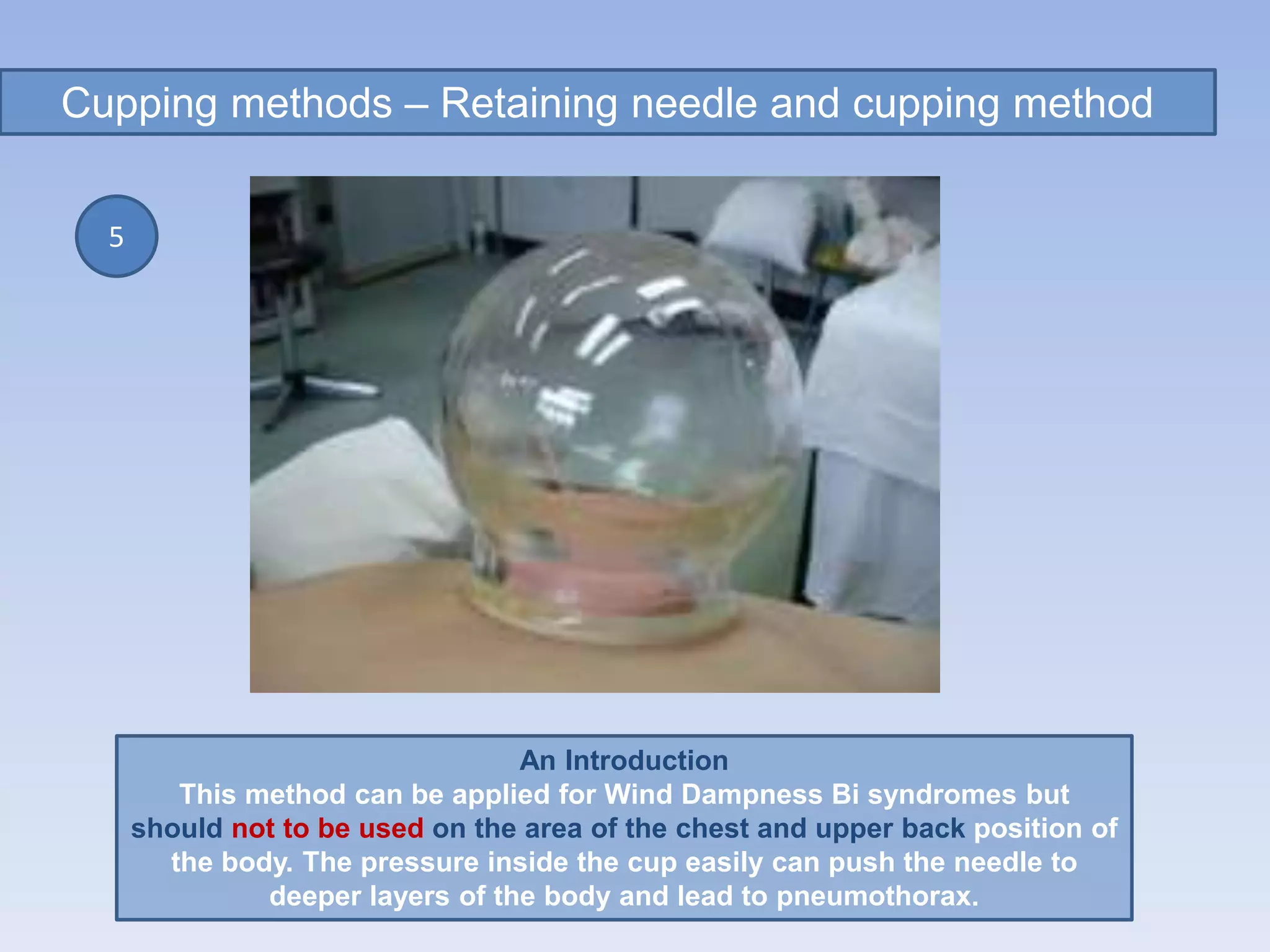 Learn about Cupping therapy | PPTX