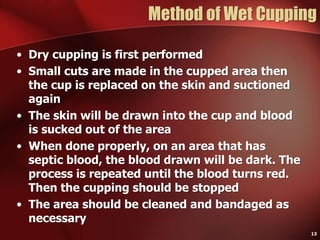 Cupping therapy | PPT