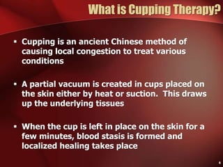 Cupping therapy | PPT