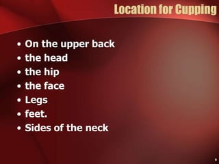 Cupping therapy | PPT