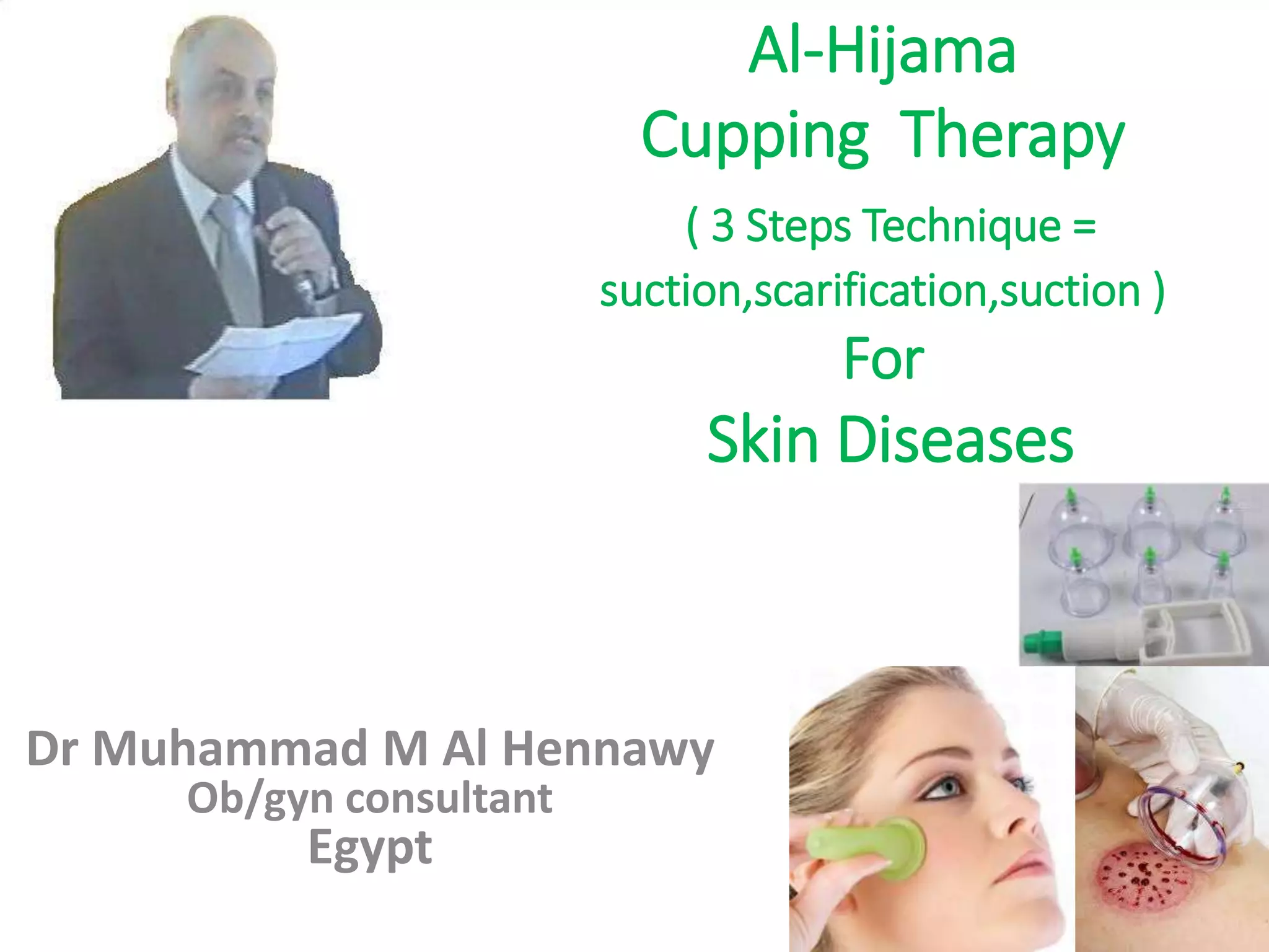 Cupping therapyforskindiseases | PPTX | First Aid | Injuries