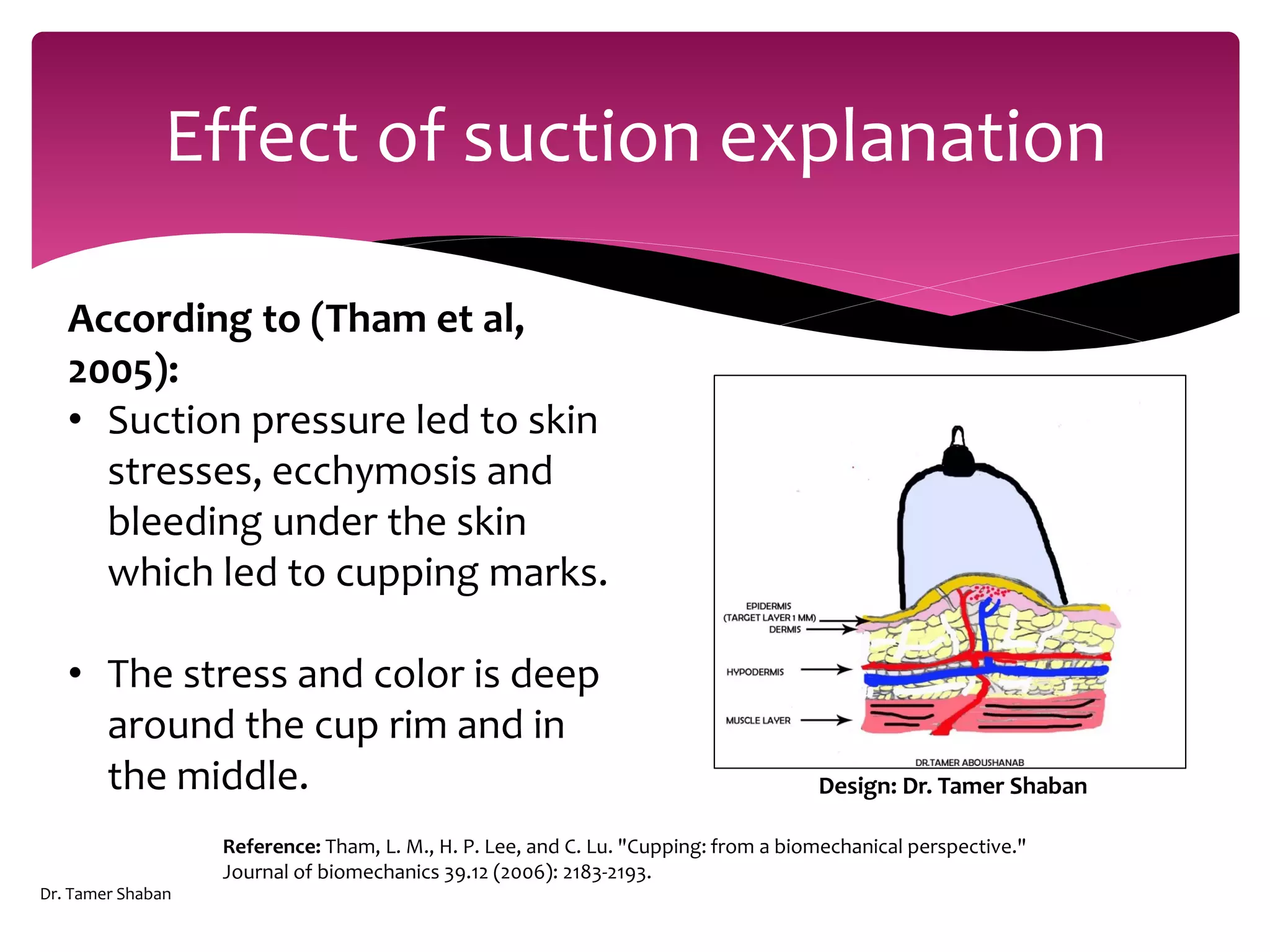 Skin Color Changes During Cupping Therapy : Explanations and ...