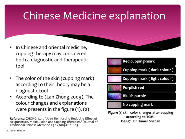 Skin Color Changes During Cupping Therapy : Explanations and ...