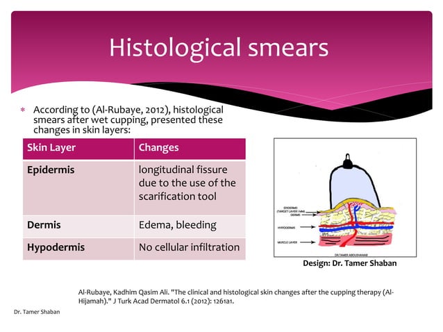 Skin Color Changes During Cupping Therapy : Explanations and ...