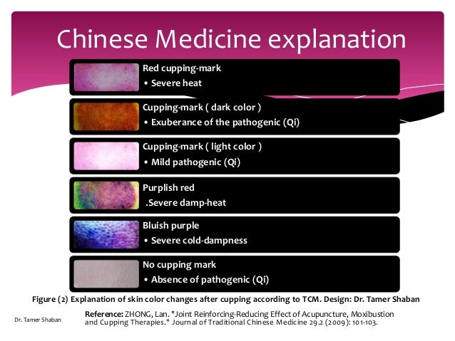 Skin Color Changes During Cupping Therapy : Explanations and Applicat…