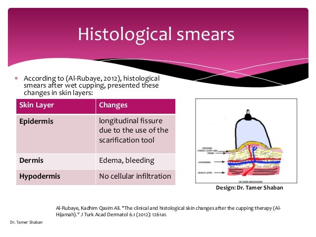 Skin Color Changes During Cupping Therapy : Explanations and Applicat…