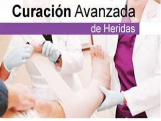 Curación heridas | PPTX