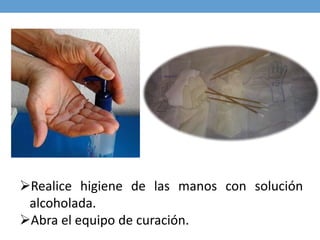 Curacion cateter picc neonato | PPTX