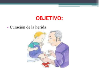Curacion de heridas-Práctcia de enfermería | PPTX