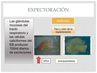 aparato respiratorio- semiologia | PPT
