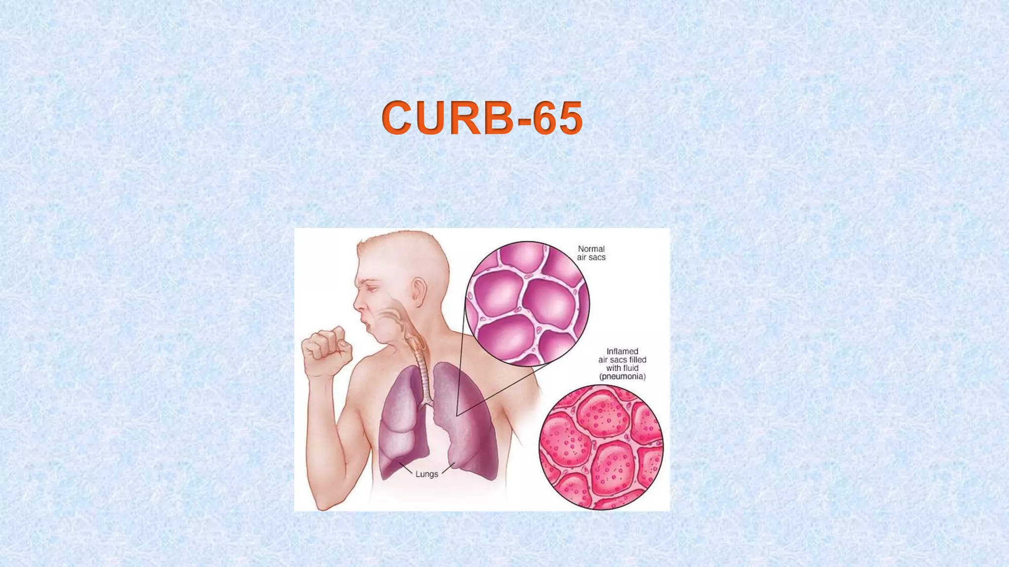 curb 65.pptx