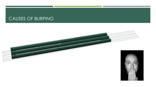 Cure burping | PPT