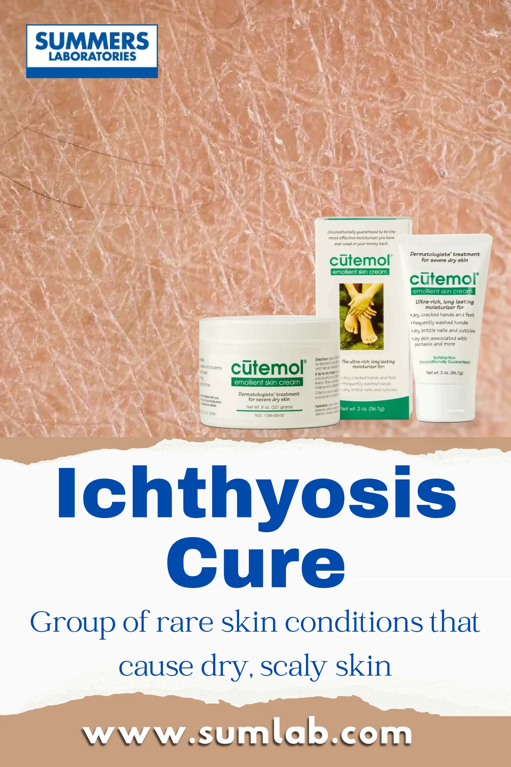 What are the most effective treatments for Ichthyosis? | PDF