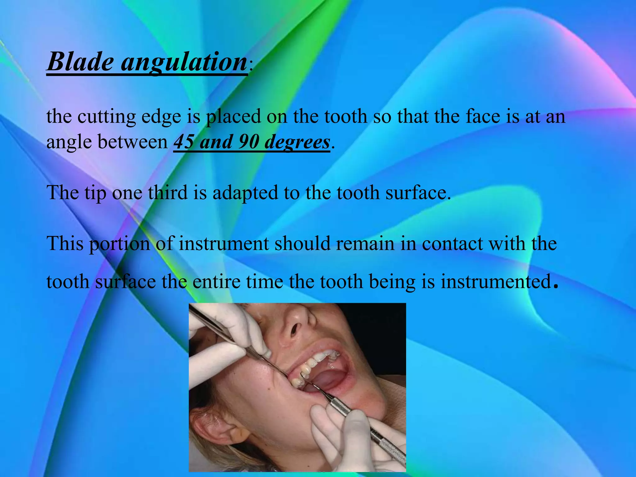 Curettes | PPTX