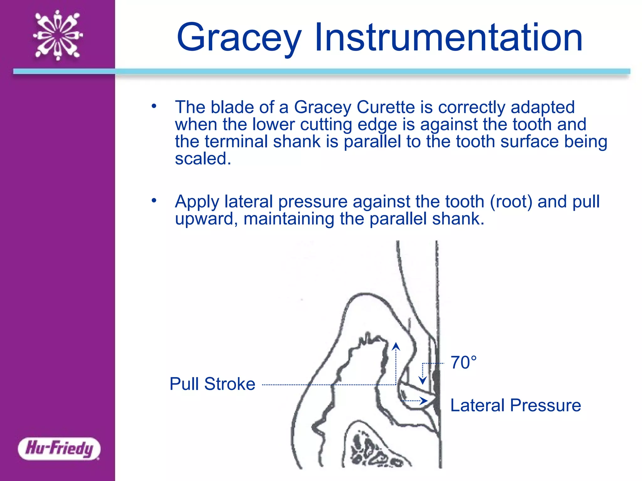 Curettes Clinical Application Guide | PPT