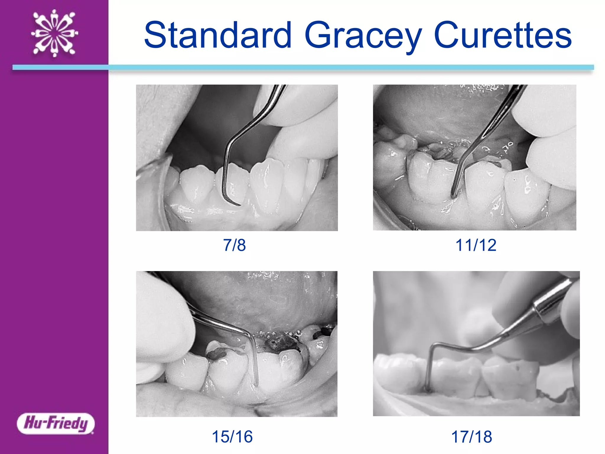 Curettes Clinical Application Guide | PPT