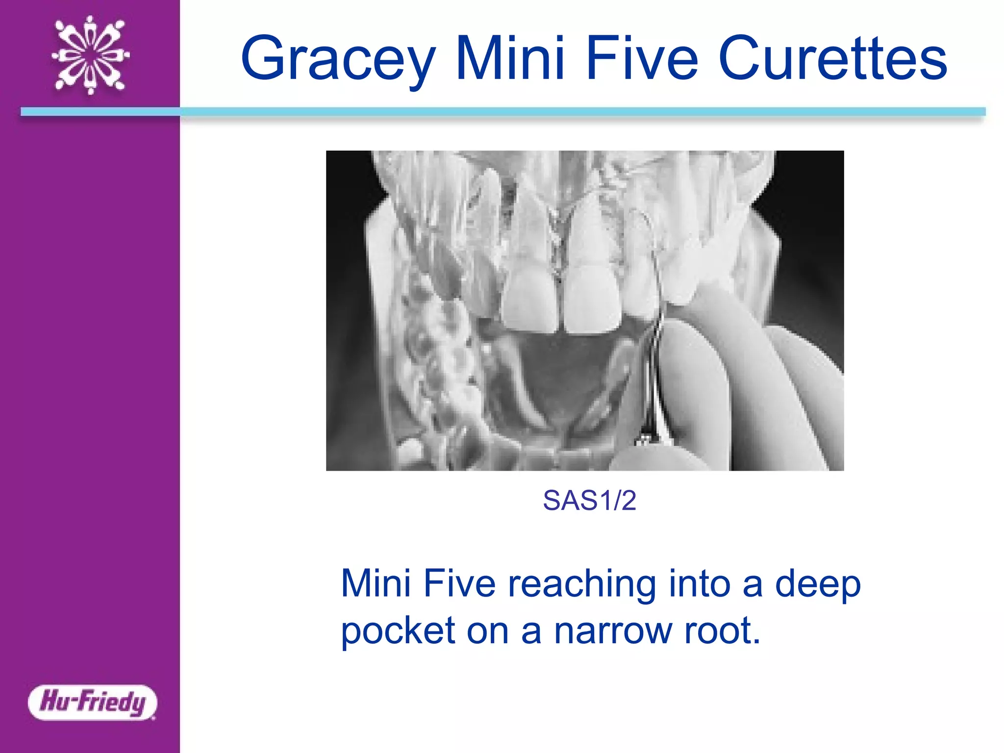 Curettes Clinical Application Guide | PPT