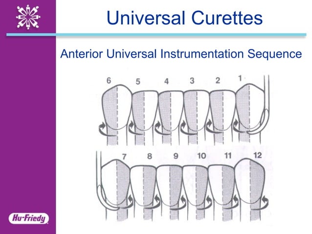 Curettes Clinical Application Guide | PPT