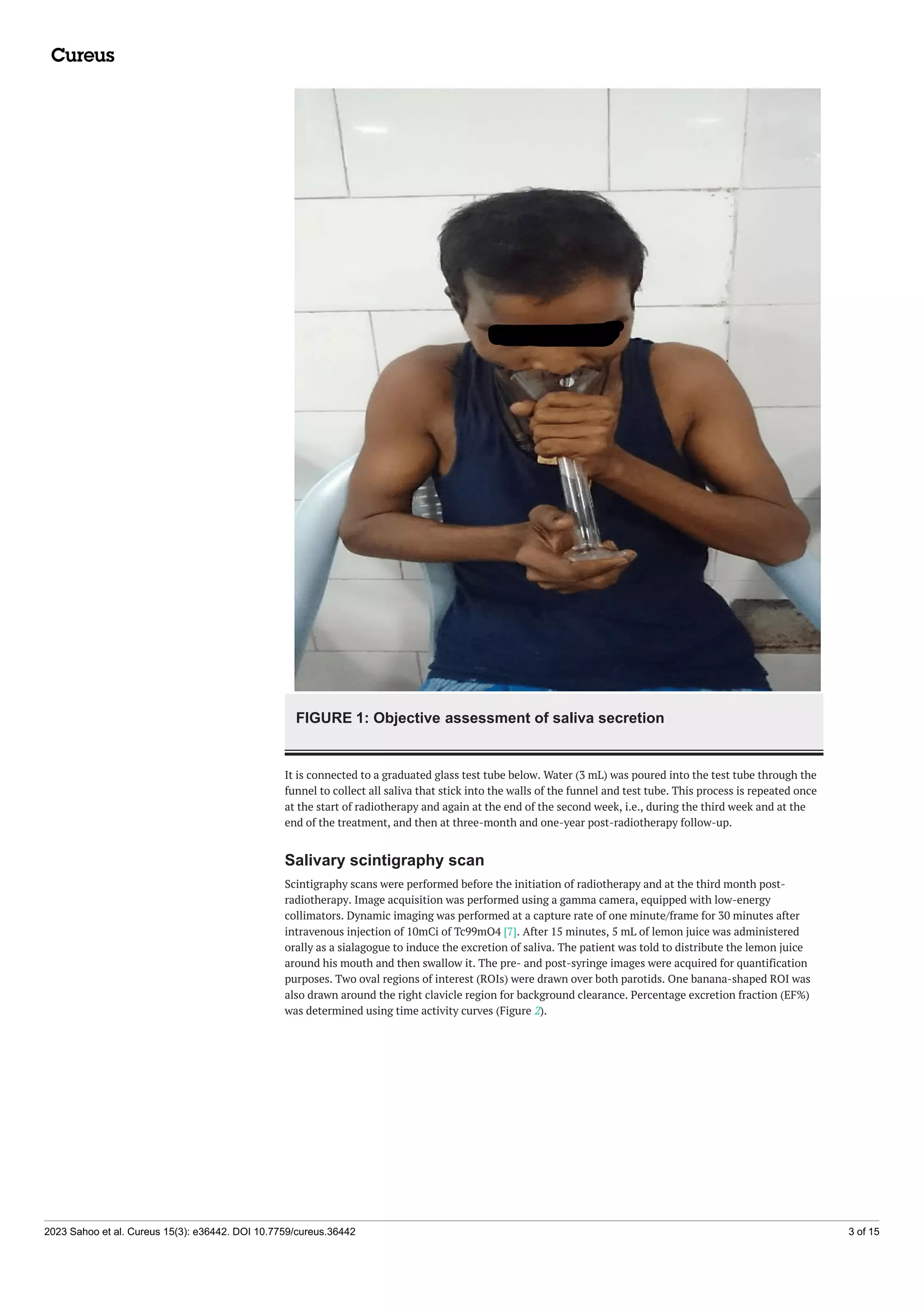 XEROSTOMIA ARTICLE | PDF