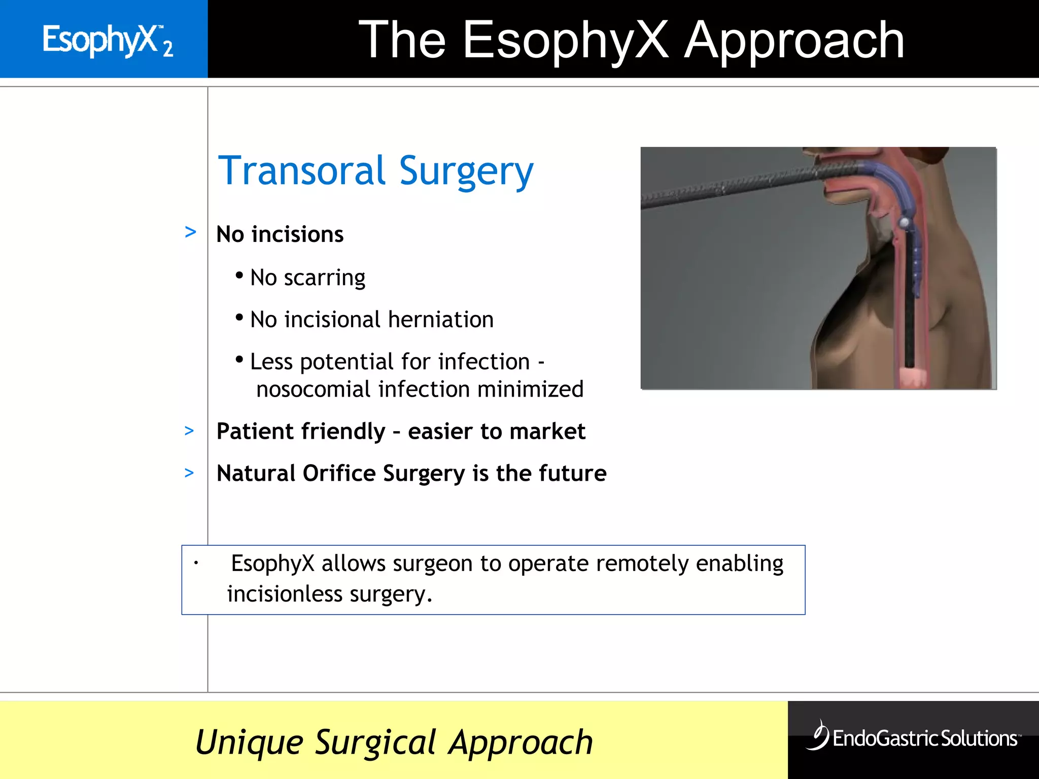 Overview of Endoscopic Gastric Fundoplication | PPT