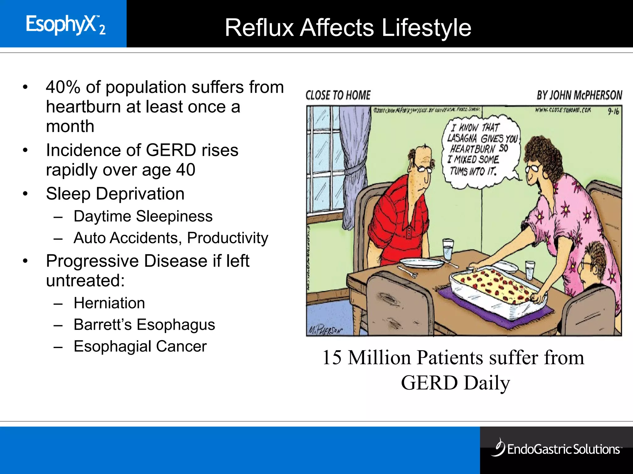 Overview of Endoscopic Gastric Fundoplication | PPT