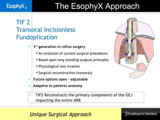 Overview of Endoscopic Gastric Fundoplication | PPT
