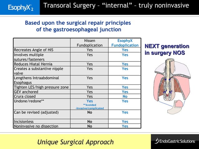 Overview of Endoscopic Gastric Fundoplication | PPT | Digestive ...