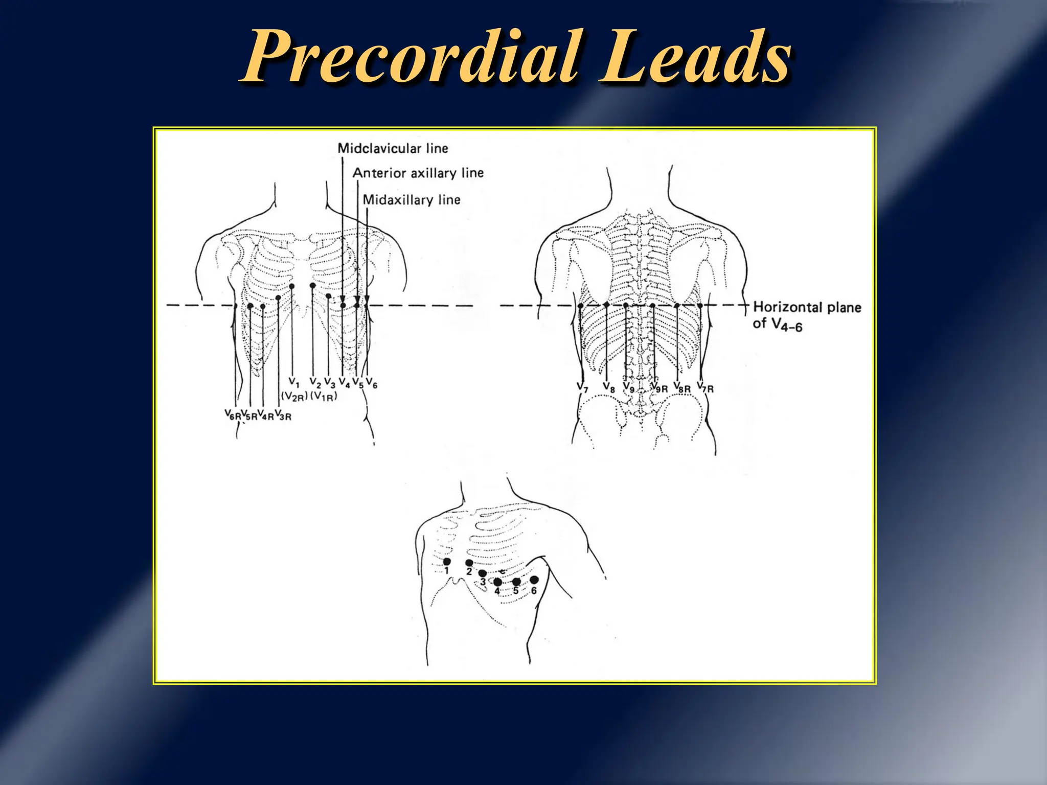 Pediatric EGC interpretation... Overview of pediatric ECG | PDF
