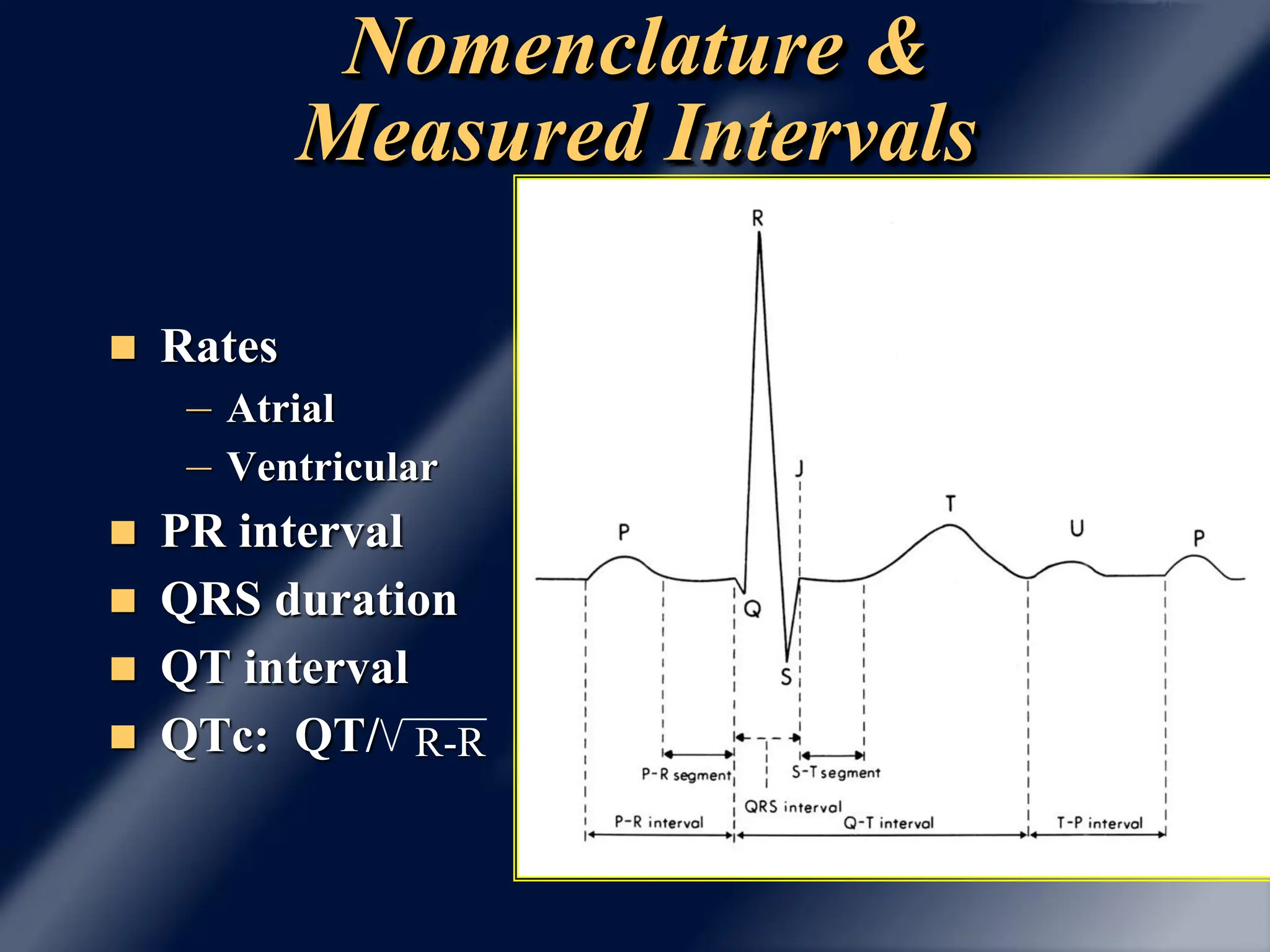Pediatric EGC interpretation... Overview of pediatric ECG | PDF
