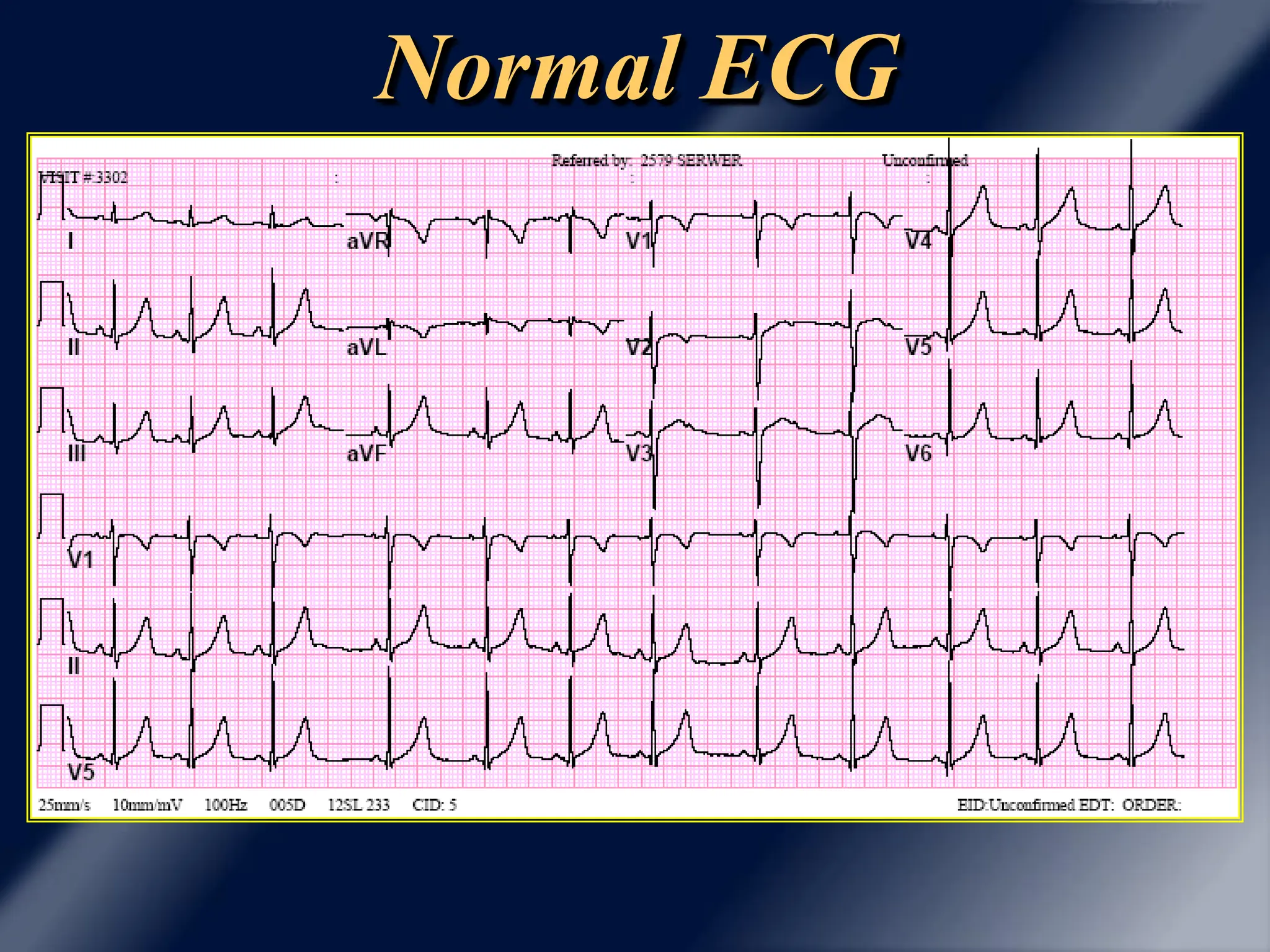 Pediatric EGC interpretation... Overview of pediatric ECG | PDF